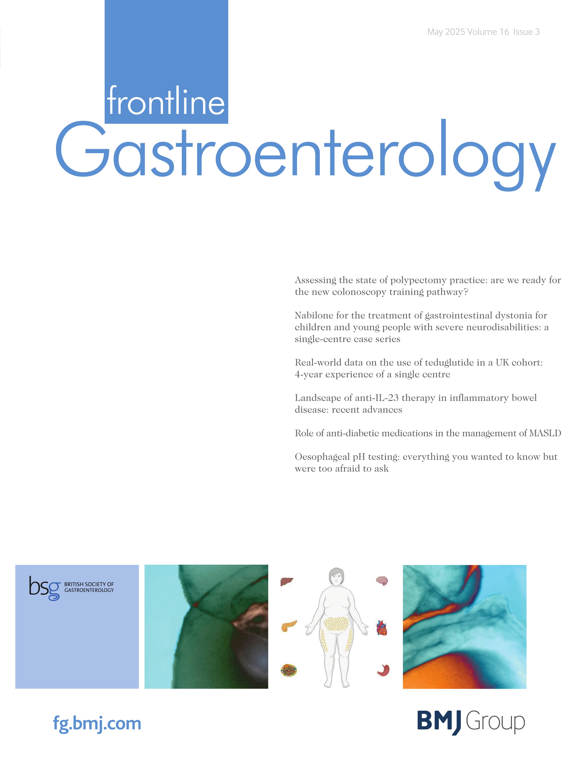 Landscape of anti-IL-23 therapy in inflammatory bowel disease: recent ...